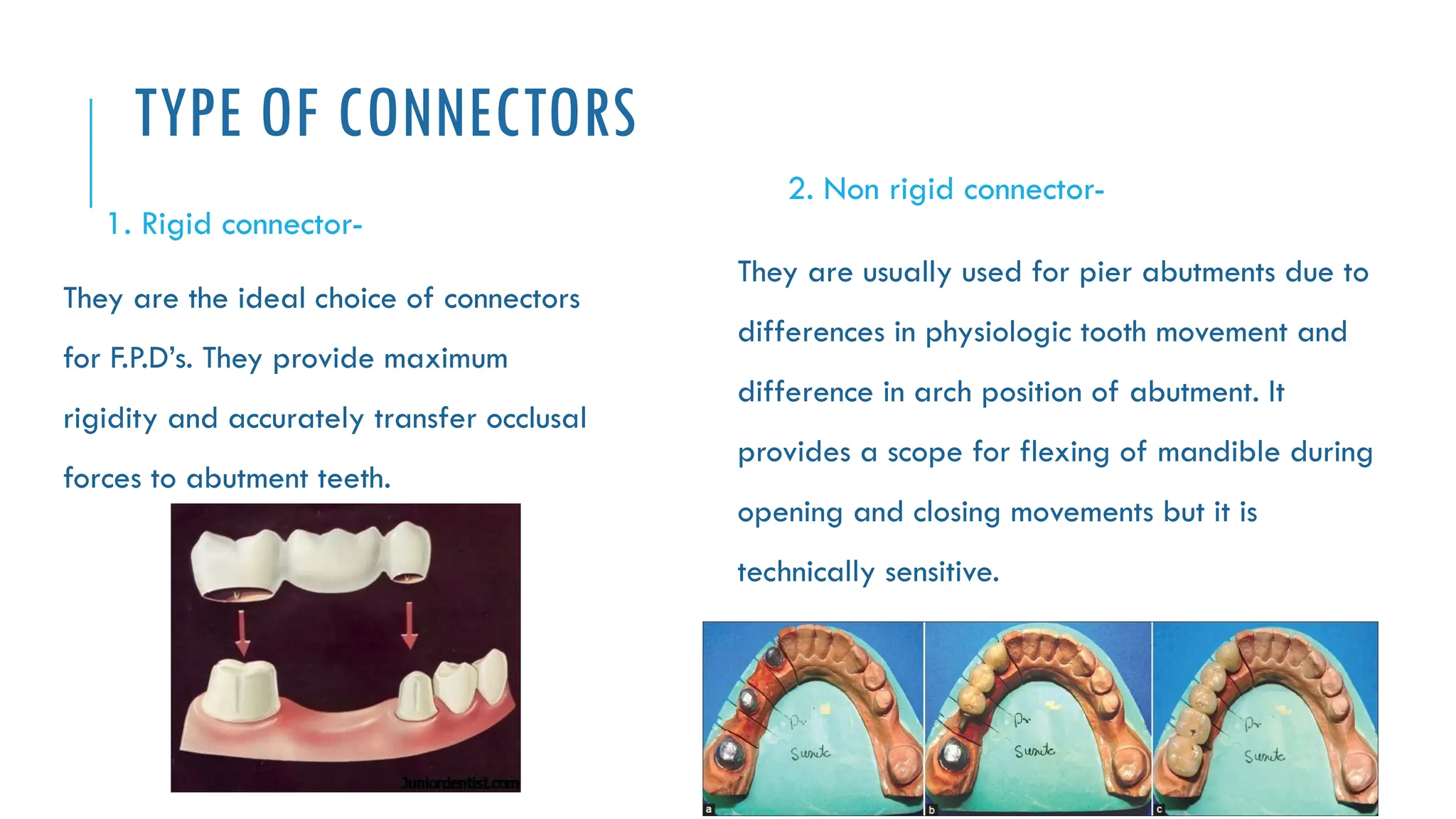 CONNECTORS AND SOLDERS IN FIXED DENTAL PROSTHESIS | PPTX