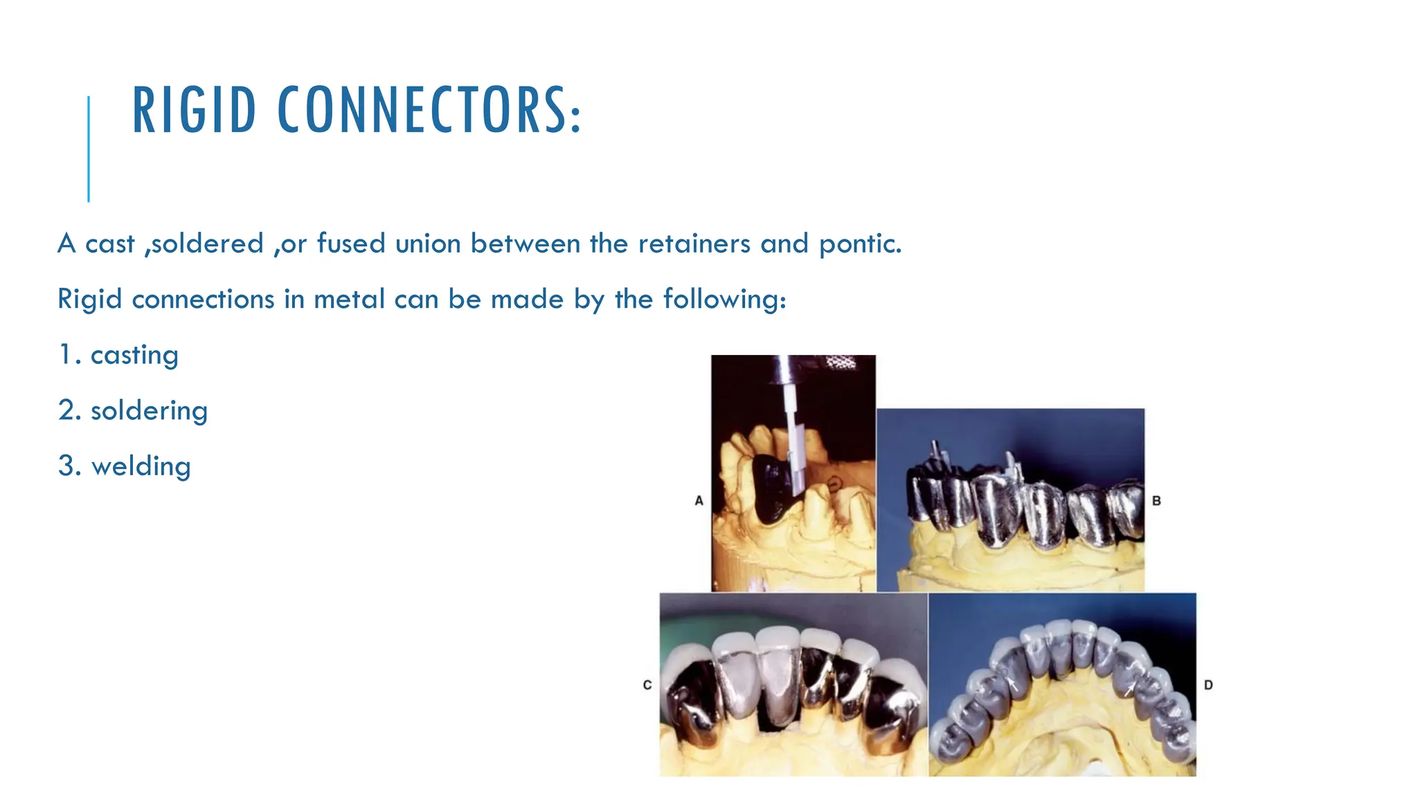 CONNECTORS AND SOLDERS IN FIXED DENTAL PROSTHESIS | PPTX