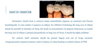 CONNECTORS AND SOLDERS IN FIXED DENTAL PROSTHESIS | PPTX