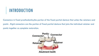 CONNECTORS AND SOLDERS IN FIXED DENTAL PROSTHESIS | PPTX