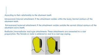 CONNECTORS AND SOLDERS IN FIXED DENTAL PROSTHESIS | PPTX