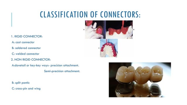 CONNECTORS AND SOLDERS IN FIXED DENTAL PROSTHESIS | PPTX