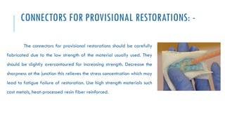 CONNECTORS AND SOLDERS IN FIXED DENTAL PROSTHESIS | PPTX