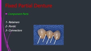 CONNECTORS in fixed prosthodontics ( Rig) | PPTX