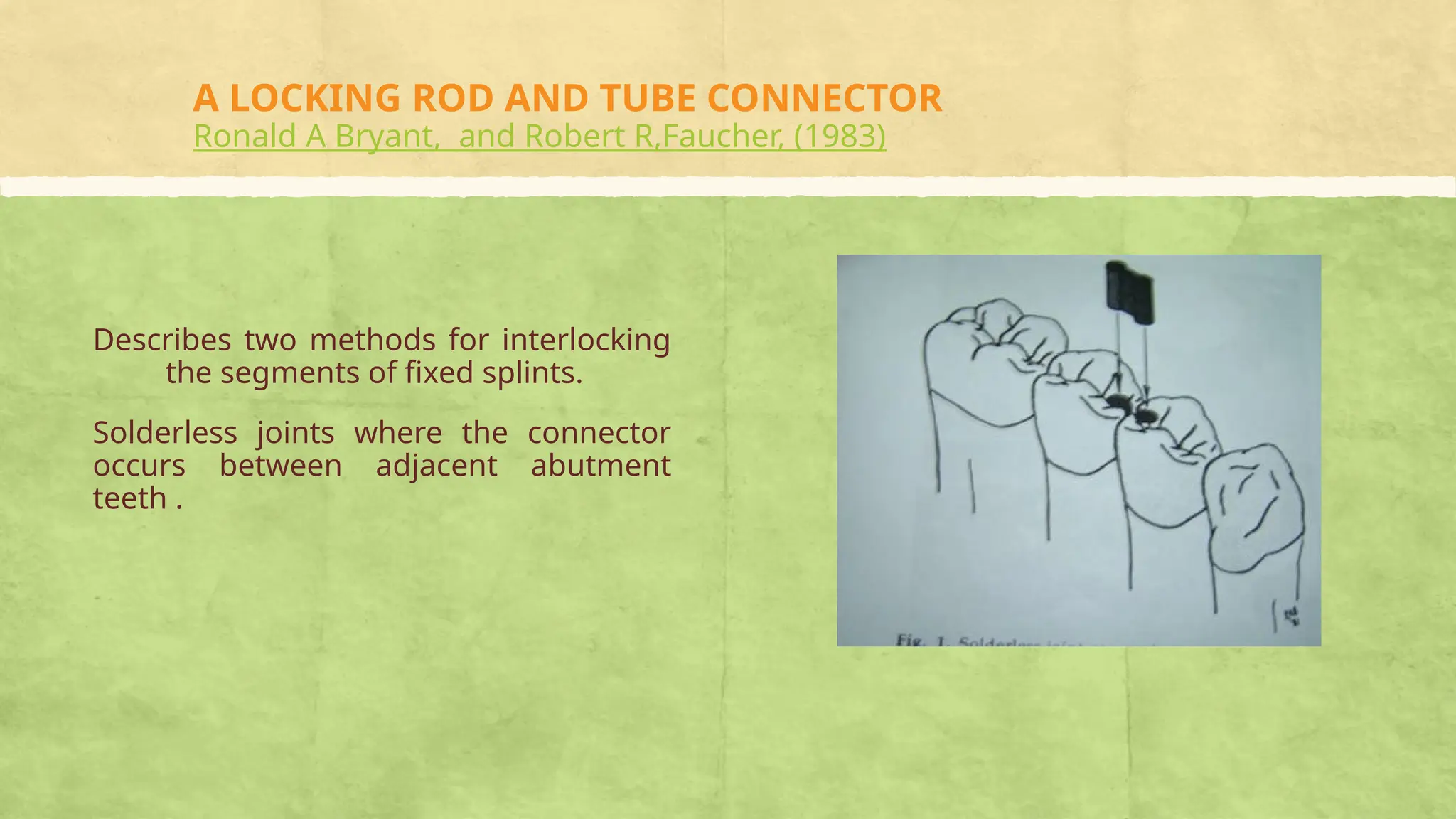 CONNECTORS IN FIXED PARTIAL DENTURE.pptx