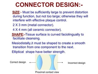 CONNECTORS IN FIXED PARTIAL DENTURE(devesh rathi).ppt