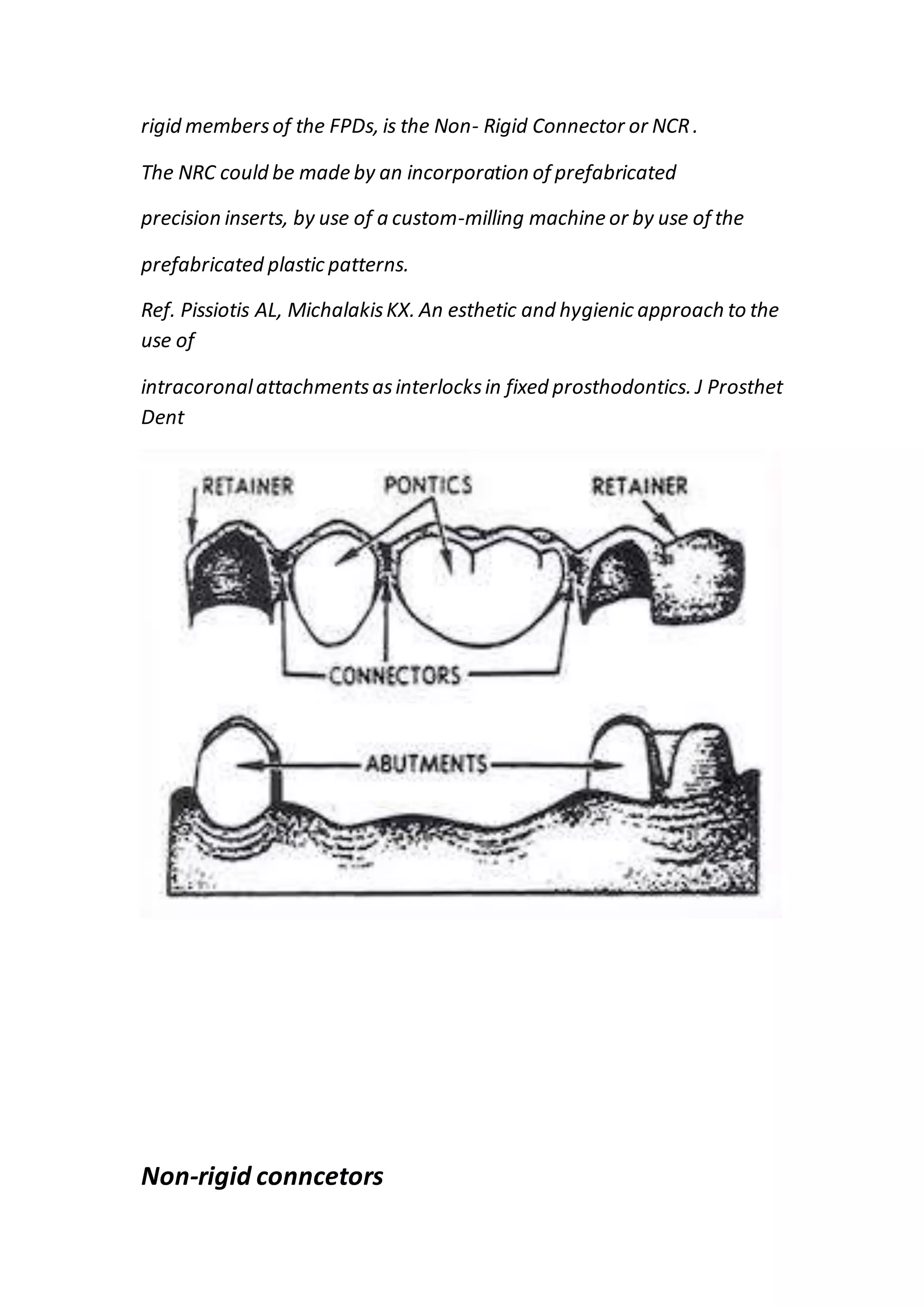 Connectors in fixed prosthodontics | DOCX