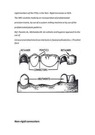 Connectors in fixed prosthodontics | DOCX