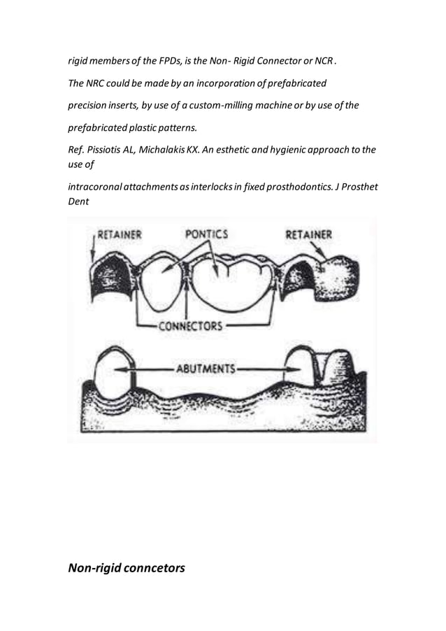 Connectors in fixed prosthodontics | DOCX