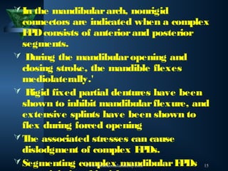 Connectors –in fpd/ dentistry schools | PPT