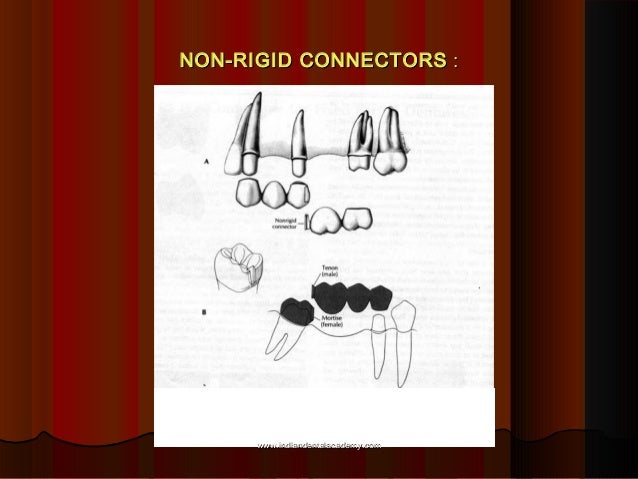 Connectors in fpd/ continued dental education