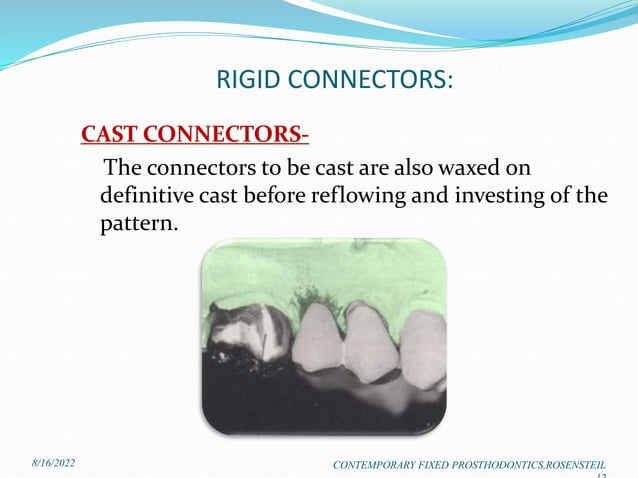 connectors in FPD.pptx | Dental Health | Diseases and Conditions