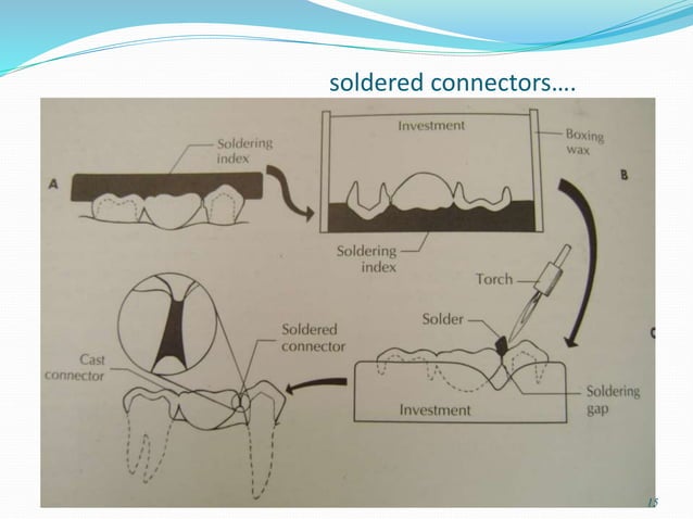 connectors in FPD.pptx | Dental Health | Diseases and Conditions