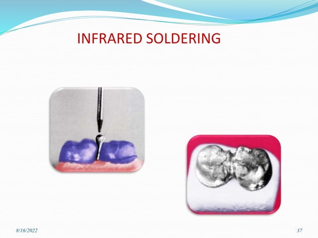 connectors in FPD.pptx | Dental Health | Diseases and Conditions