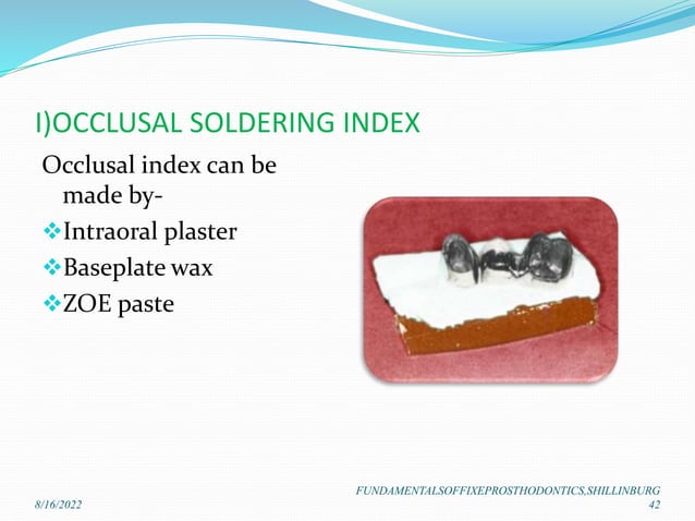 connectors in FPD.pptx | Dental Health | Diseases and Conditions