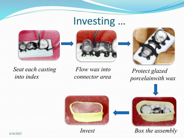 connectors in FPD.pptx | Dental Health | Diseases and Conditions