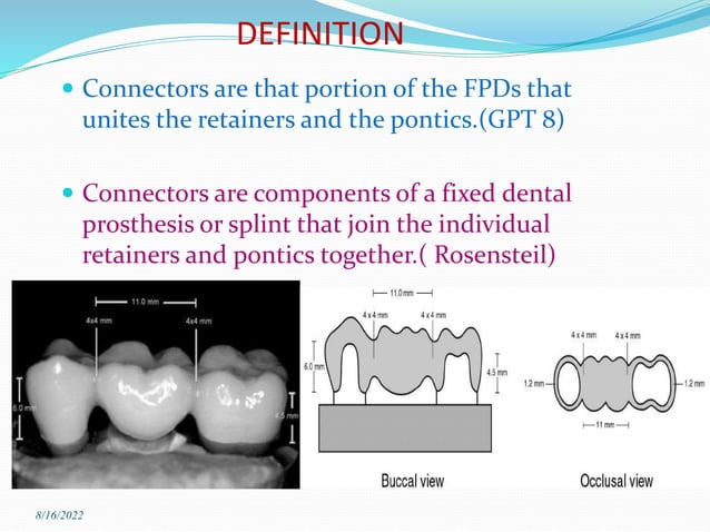 connectors in FPD.pptx | Dental Health | Diseases and Conditions