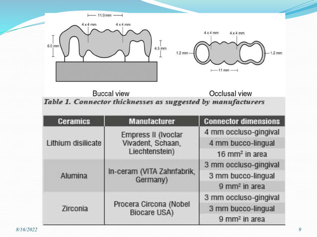 connectors in FPD.pptx | Dental Health | Diseases and Conditions