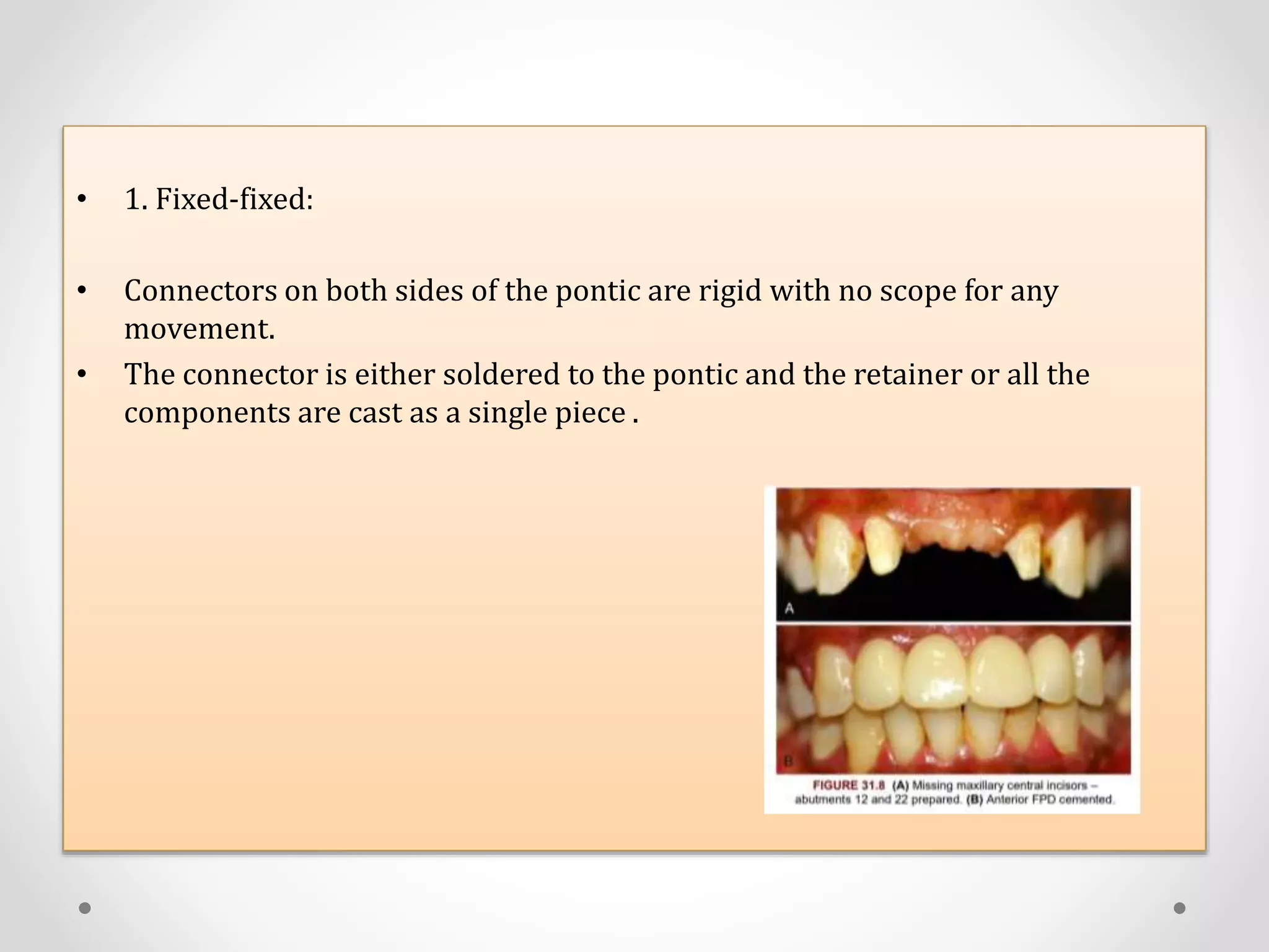CONNECTORS IN FPD.pptx