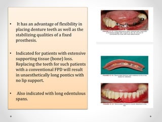 CONNECTORS IN FPD.pptx