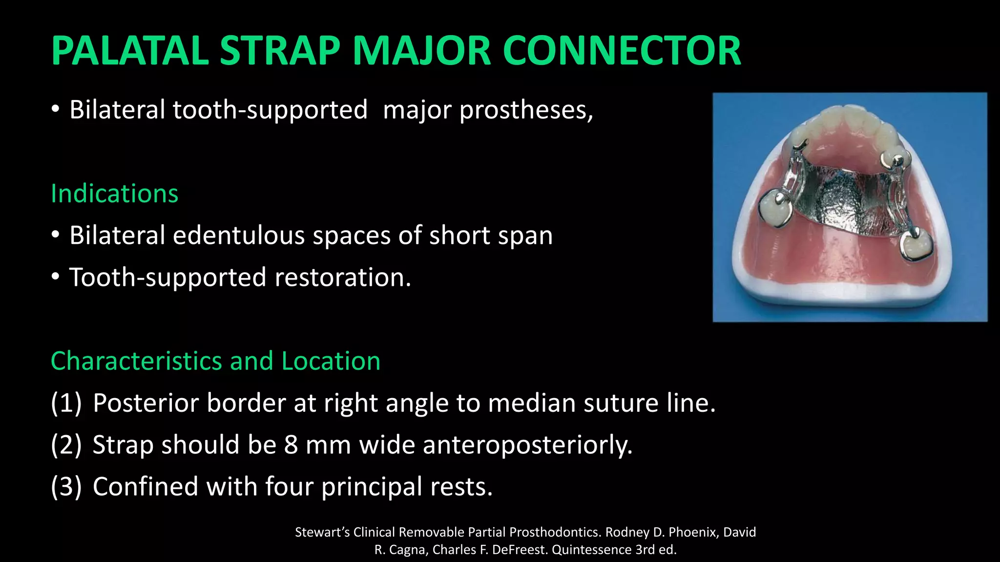 Connectors in RPD | PPTX