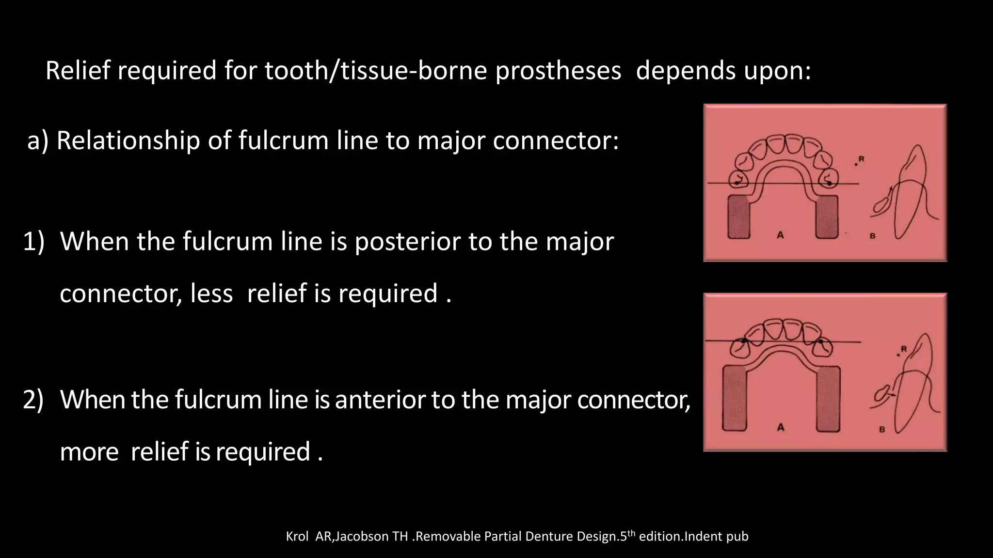 Connectors in RPD | PPTX
