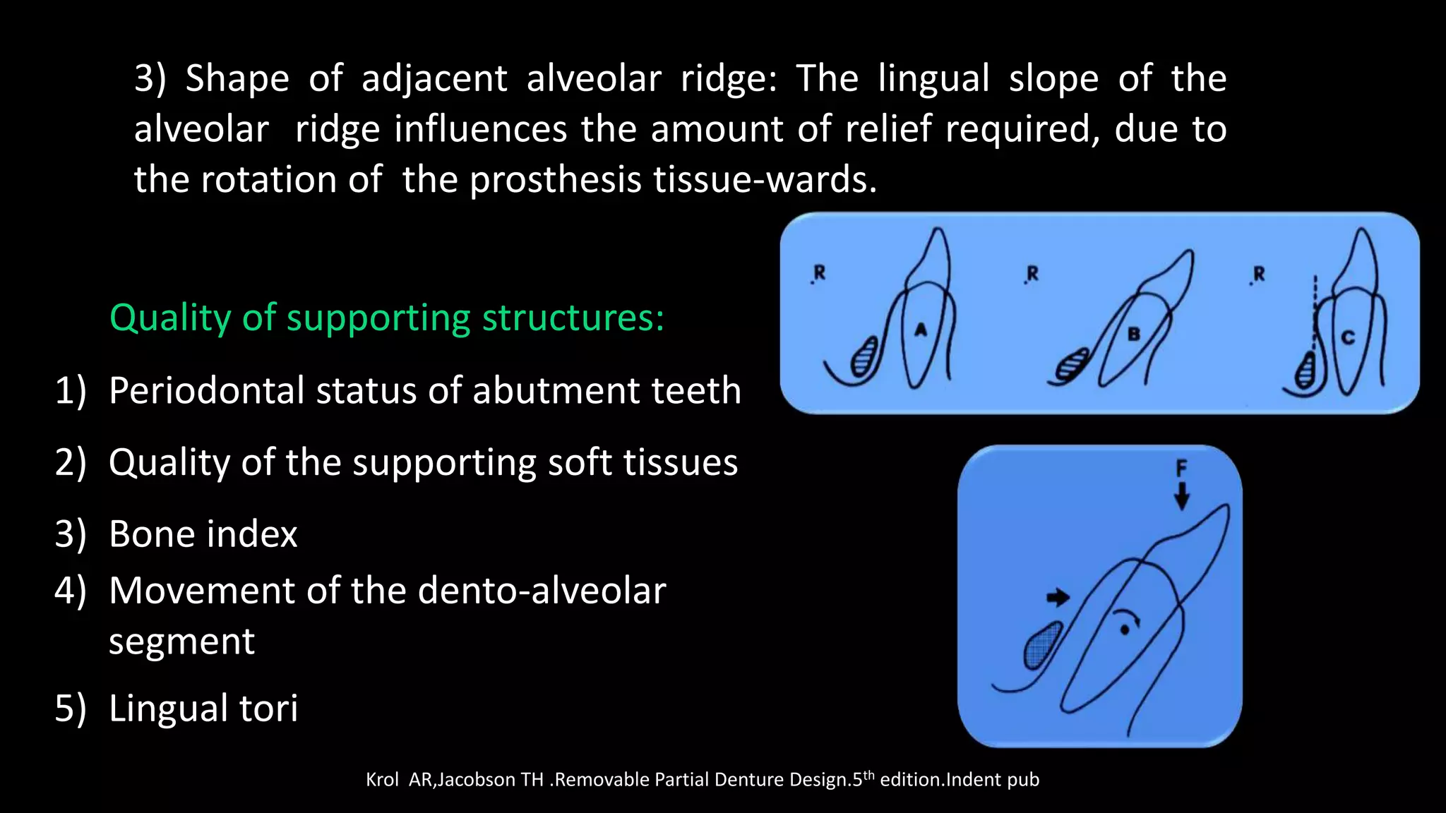Connectors in RPD | PPTX