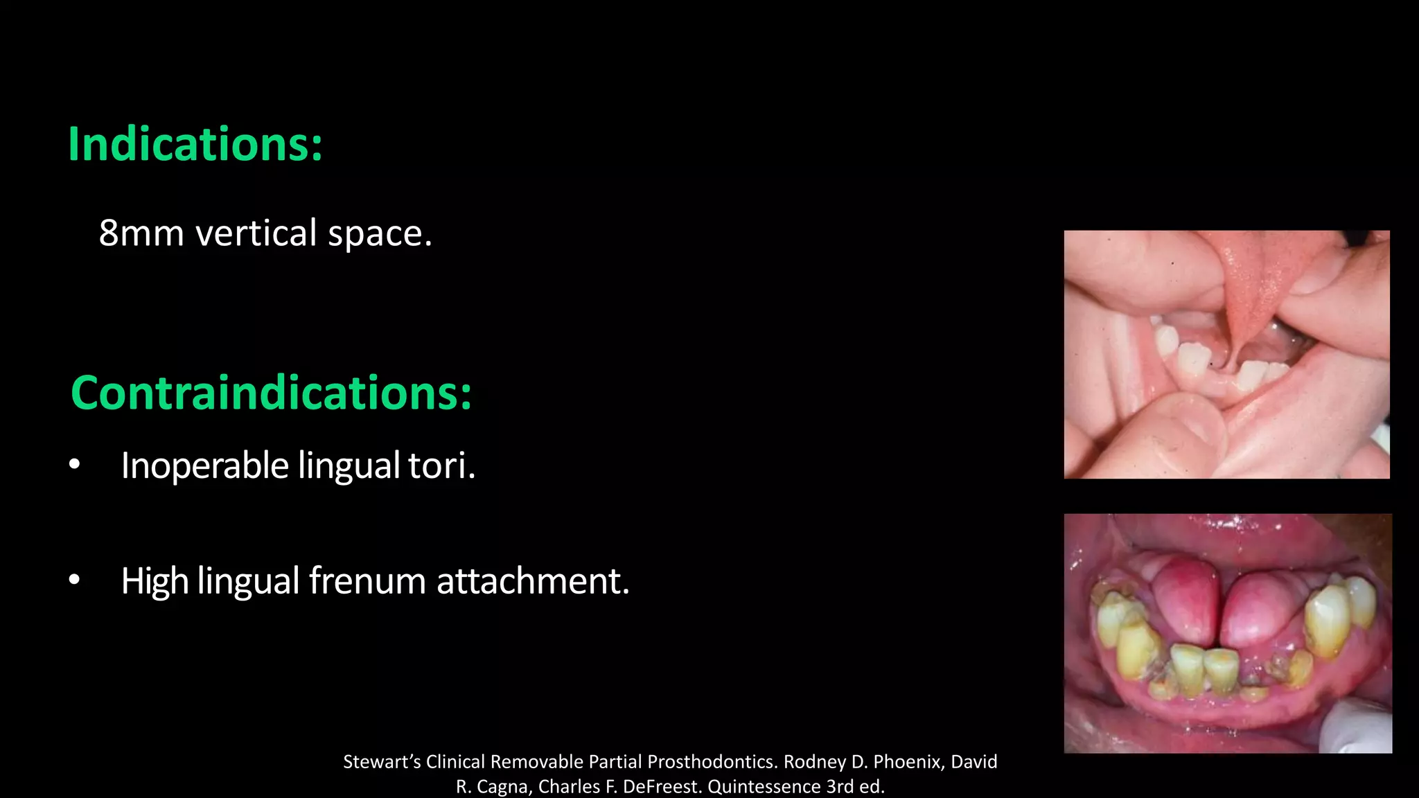Connectors in RPD | PPTX