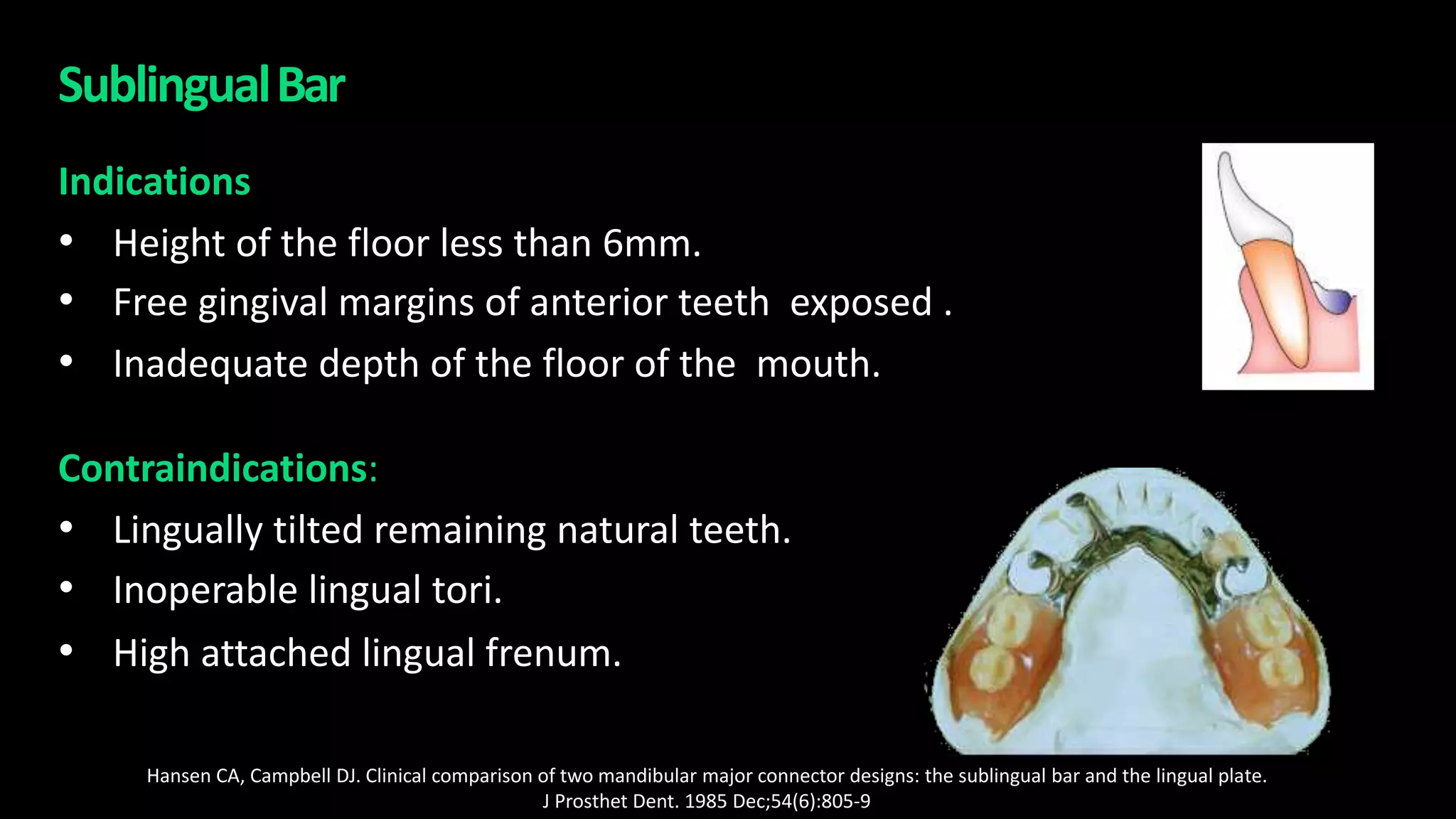 Connectors in RPD | PPTX