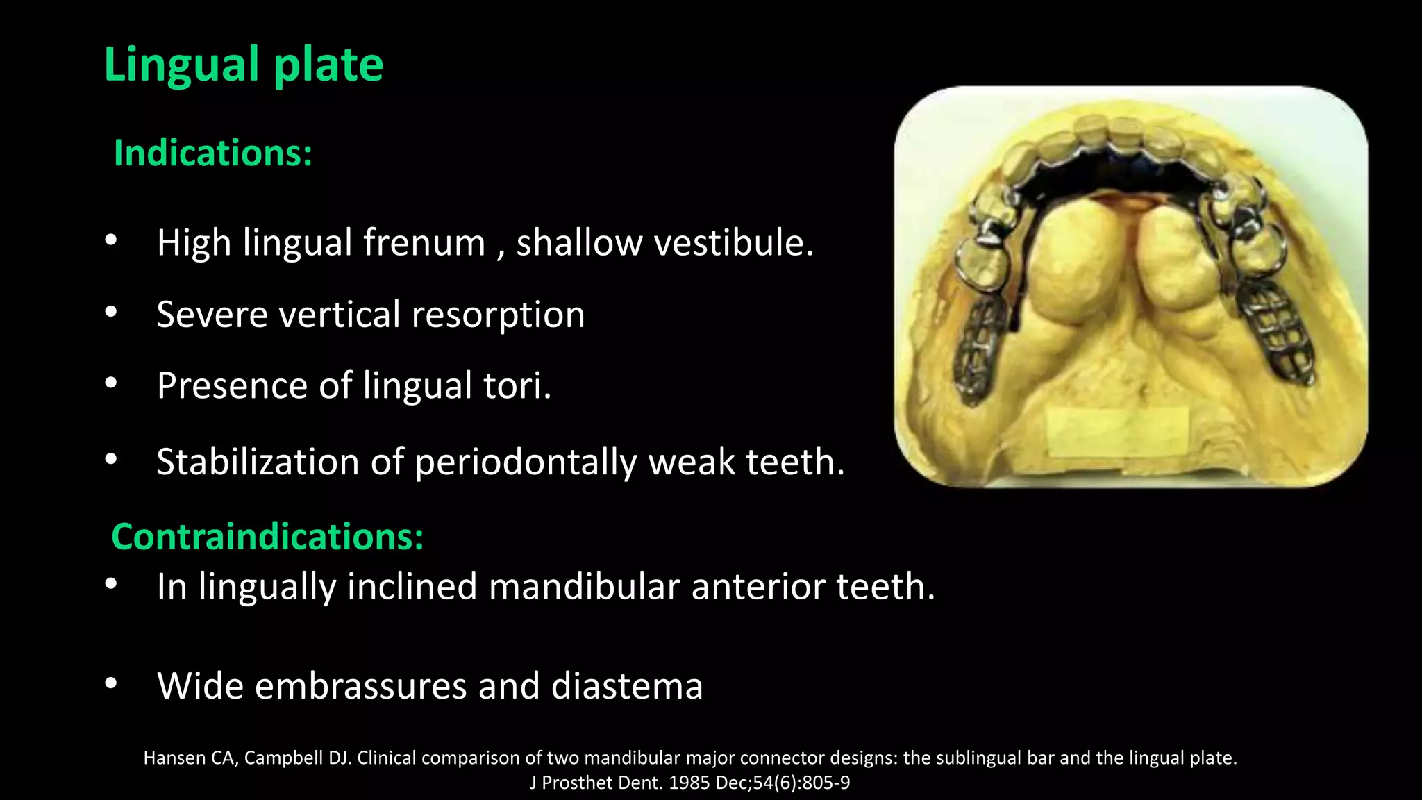 Connectors in RPD | PPTX