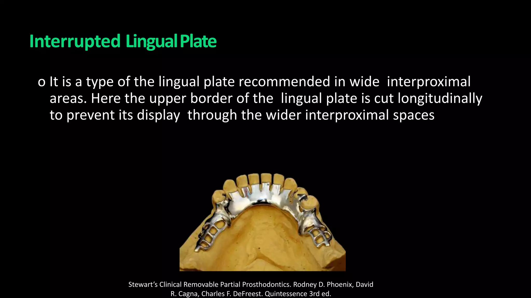 Connectors in RPD | PPTX