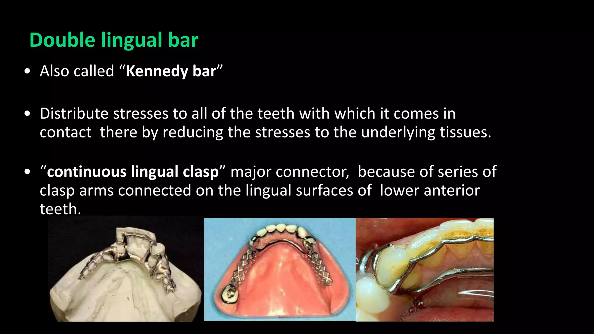 Connectors in RPD | PPTX