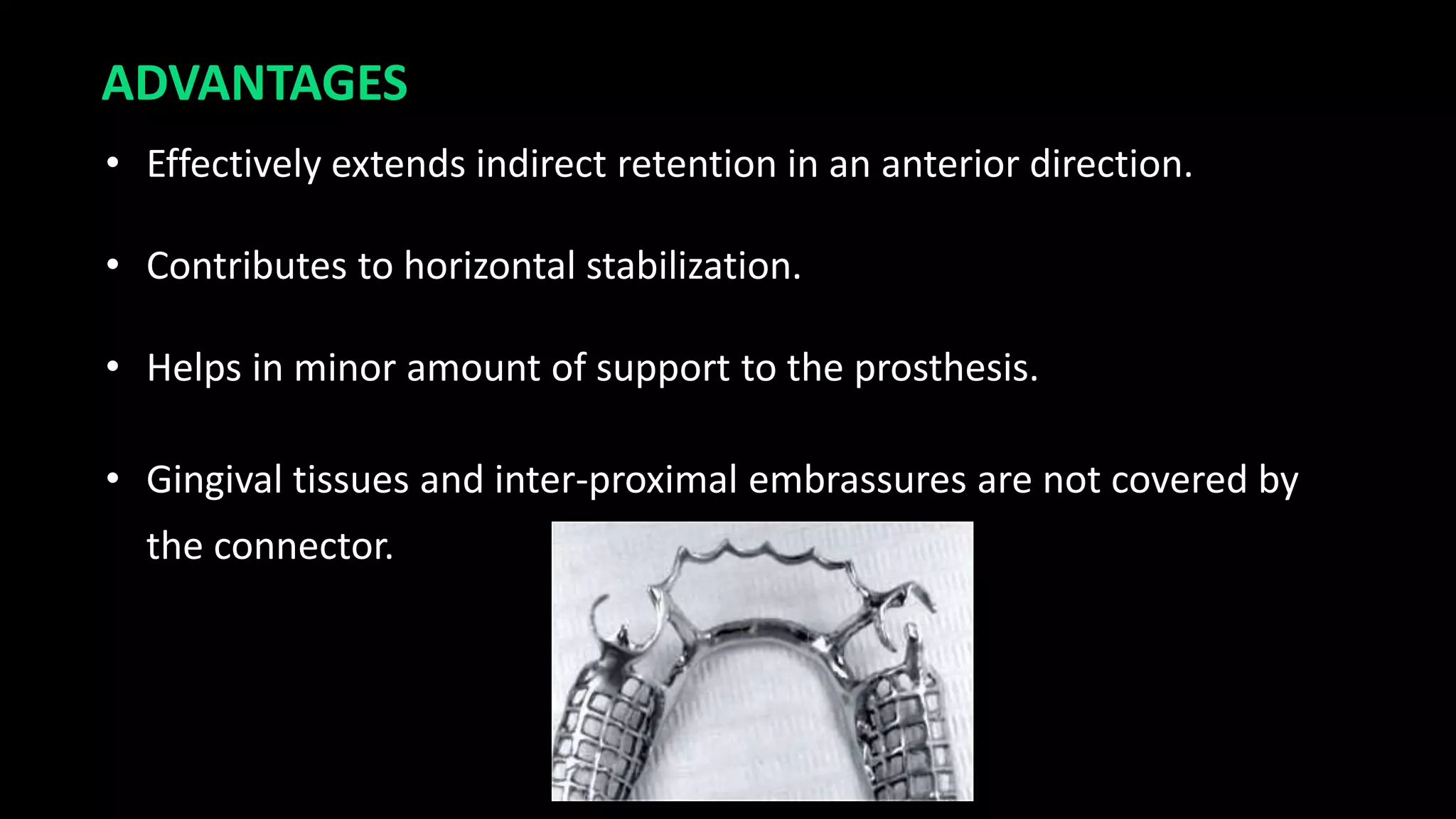Connectors in RPD | PPTX