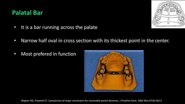 Connectors in RPD | PPTX