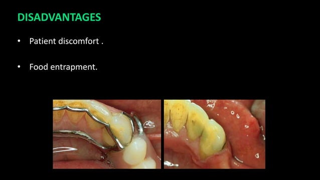 Connectors in RPD | PPTX