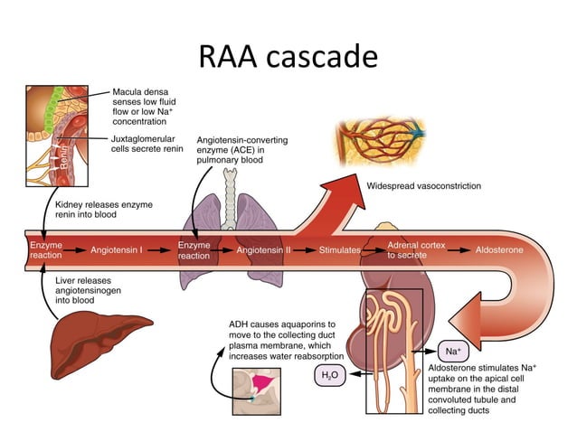 Conn’s syndrome | PPT