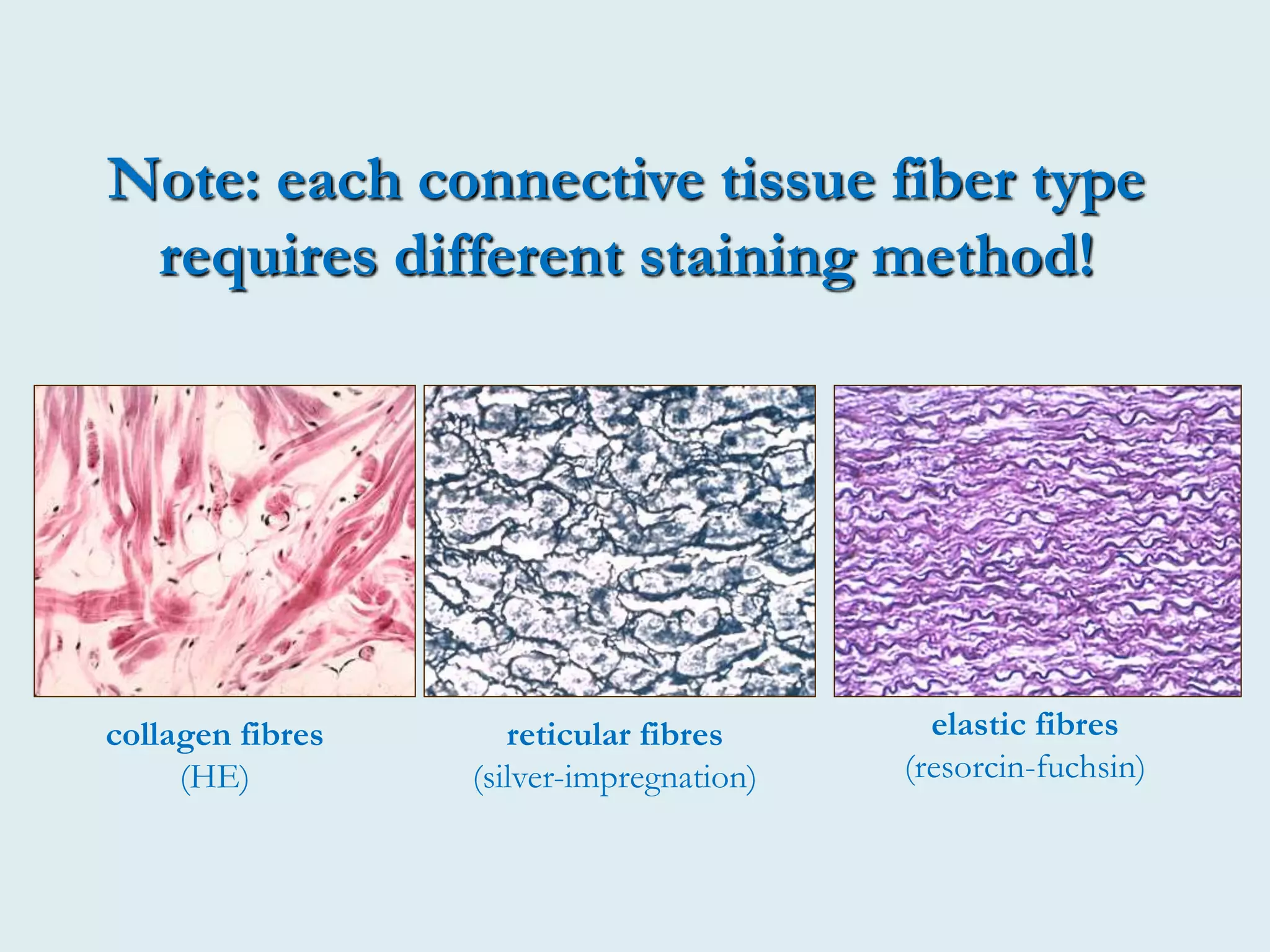 conn_tissue_fibres_types_em1_VV_2018.ppt
