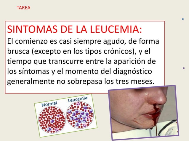 Conoce mas sobre la leucemia | PPT