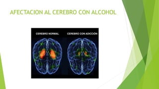CONOCIENDO MAS SOBRE LOS EFECTOS DEL ALCOHOL.pptx