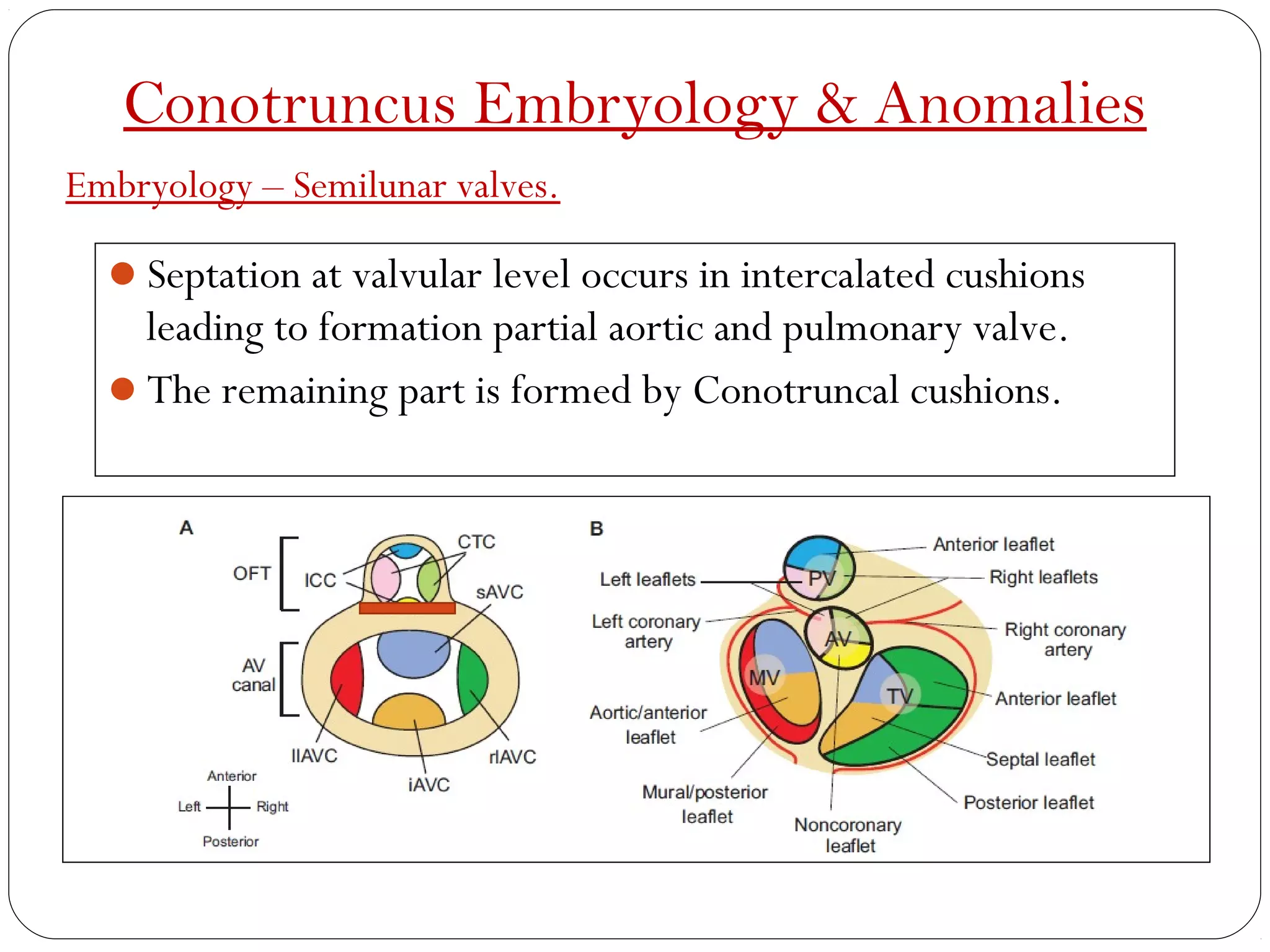 Conotruncal anamolies | PPT