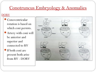 Conotruncal anamolies | PPT