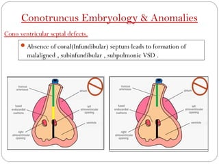 Conotruncal anamolies | PPT