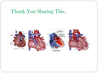 Conotruncal anamolies | PPT