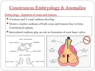 Conotruncal anamolies | PPT