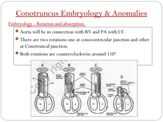 Conotruncal anamolies | PPT