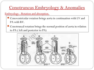 Conotruncal anamolies | PPT