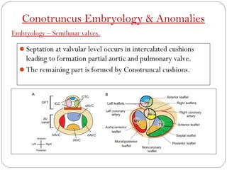 Conotruncal anamolies | PPT