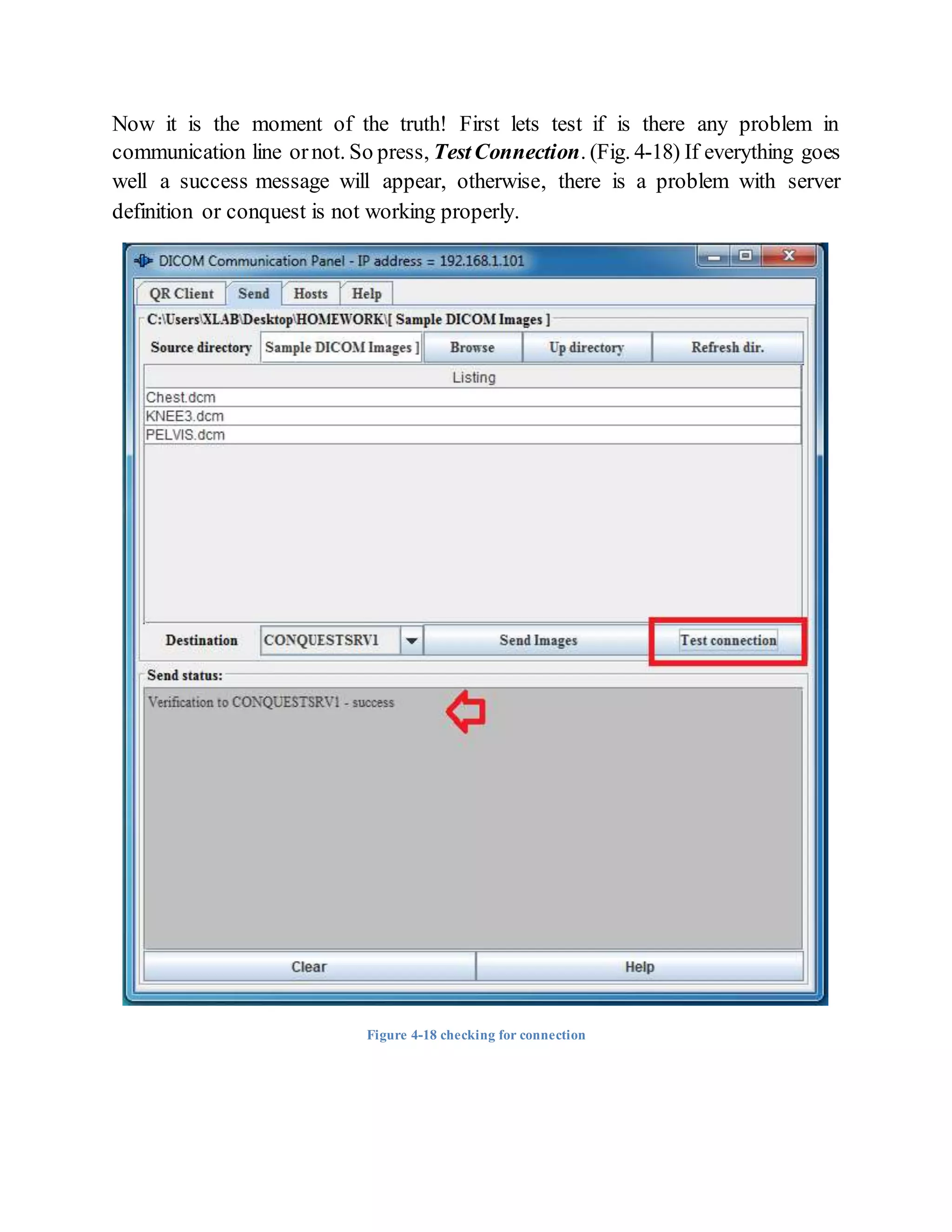 Conquest for dummies: how to setup a pacs server | DOCX