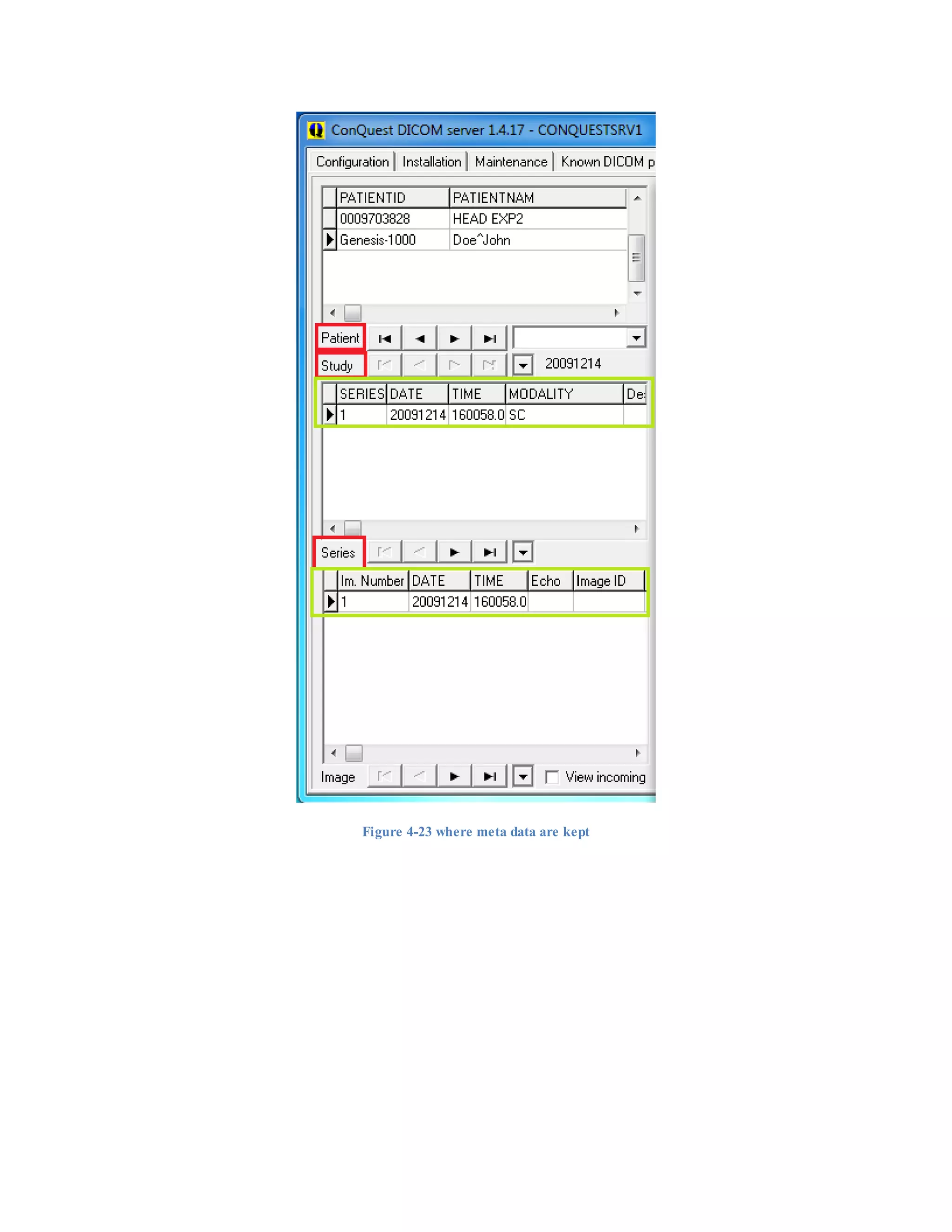 Conquest for dummies: how to setup a pacs server | DOCX