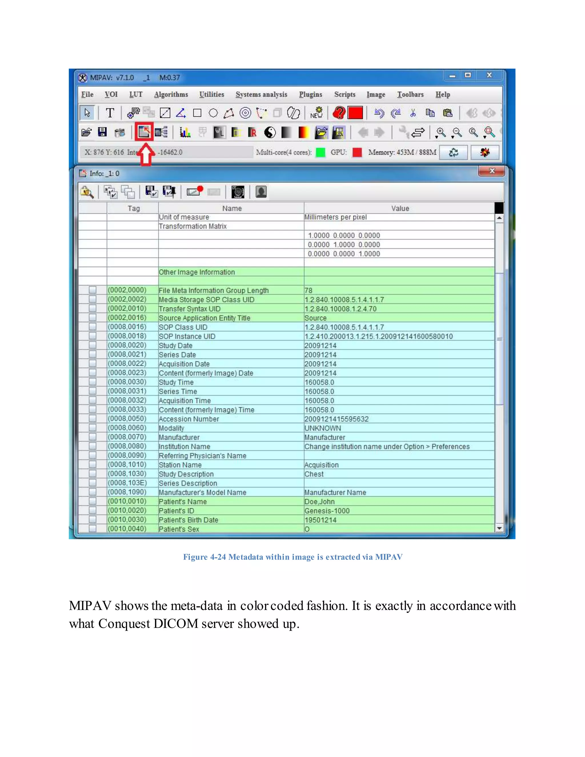 Conquest for dummies: how to setup a pacs server | DOCX